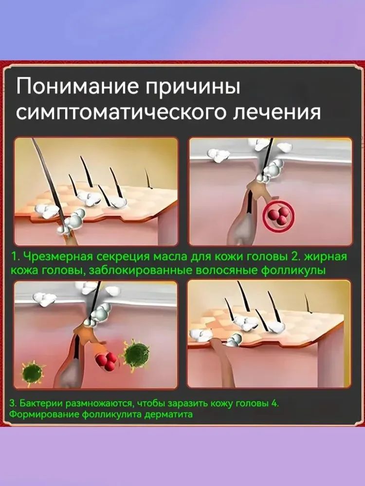 Вытягивающая мазь от фурункулов, чирей, акне и гнойников как Вишневского 50г