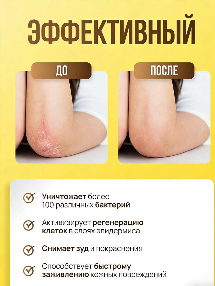 Мазь чистотел для проблемной кожи. От герпеса, от грибка ногтей и тела, от прыщей, от псориаза