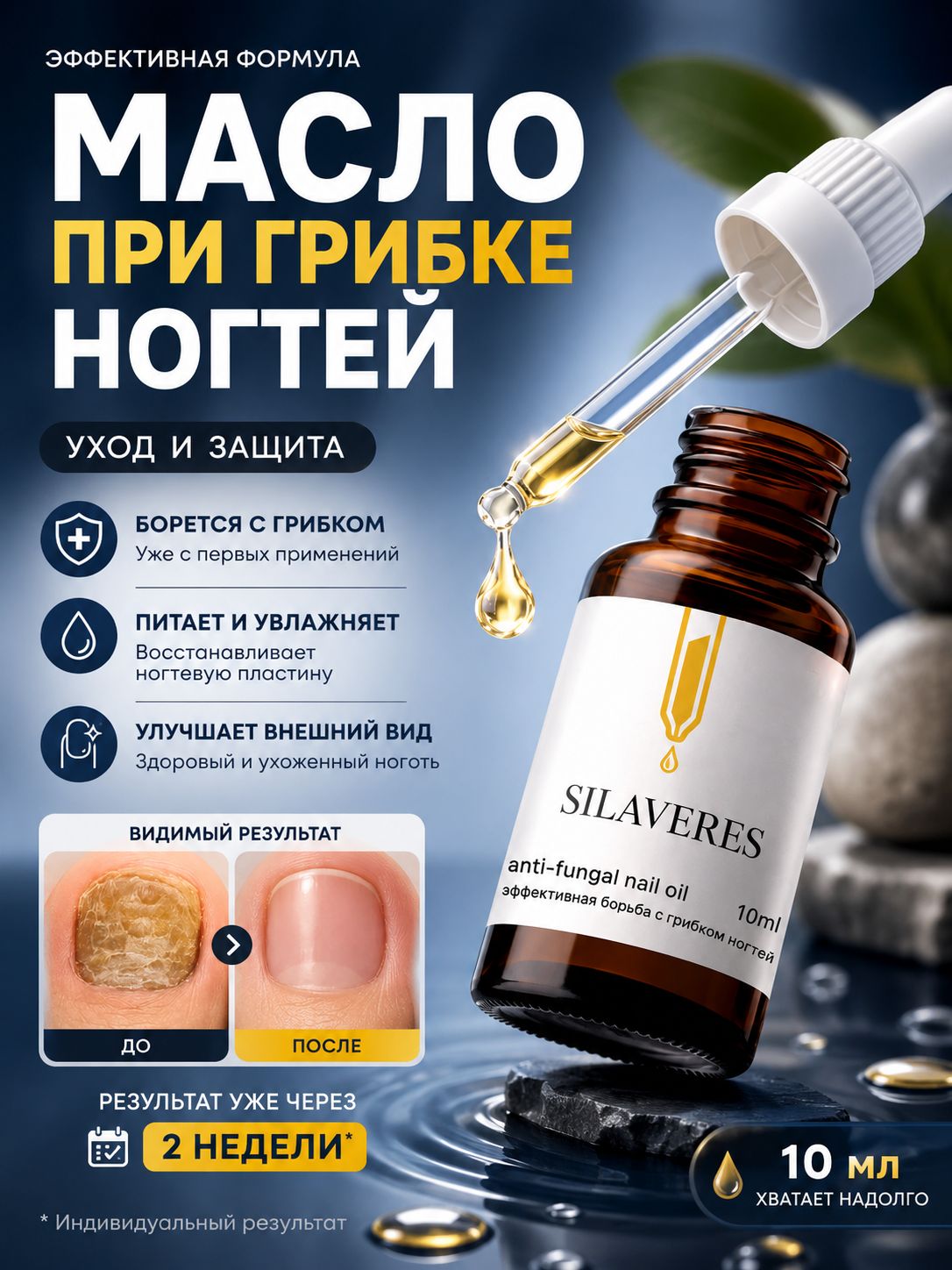 Экстракт монарды от грибка ногтей и онихолизиса SILAVERES: масло для восстановления и укрепления ногтевой пластины, антибактериальное средство, 10 мл