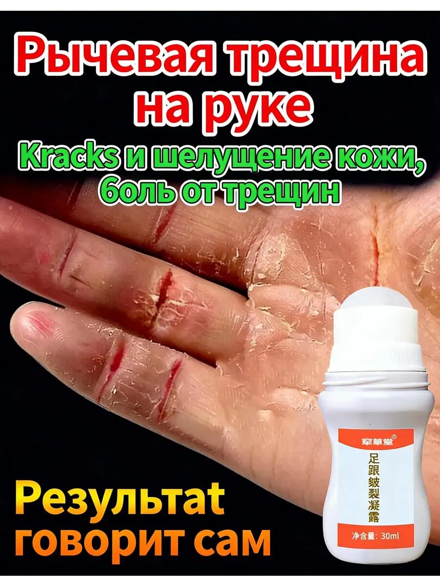 Кератолитик для пяток профессиональный30 мл