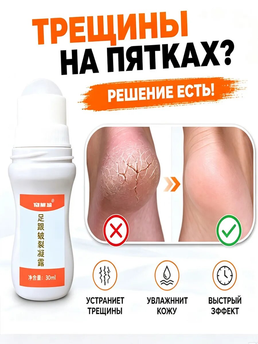 Крем 30% мочевины для сухой кожи стоп