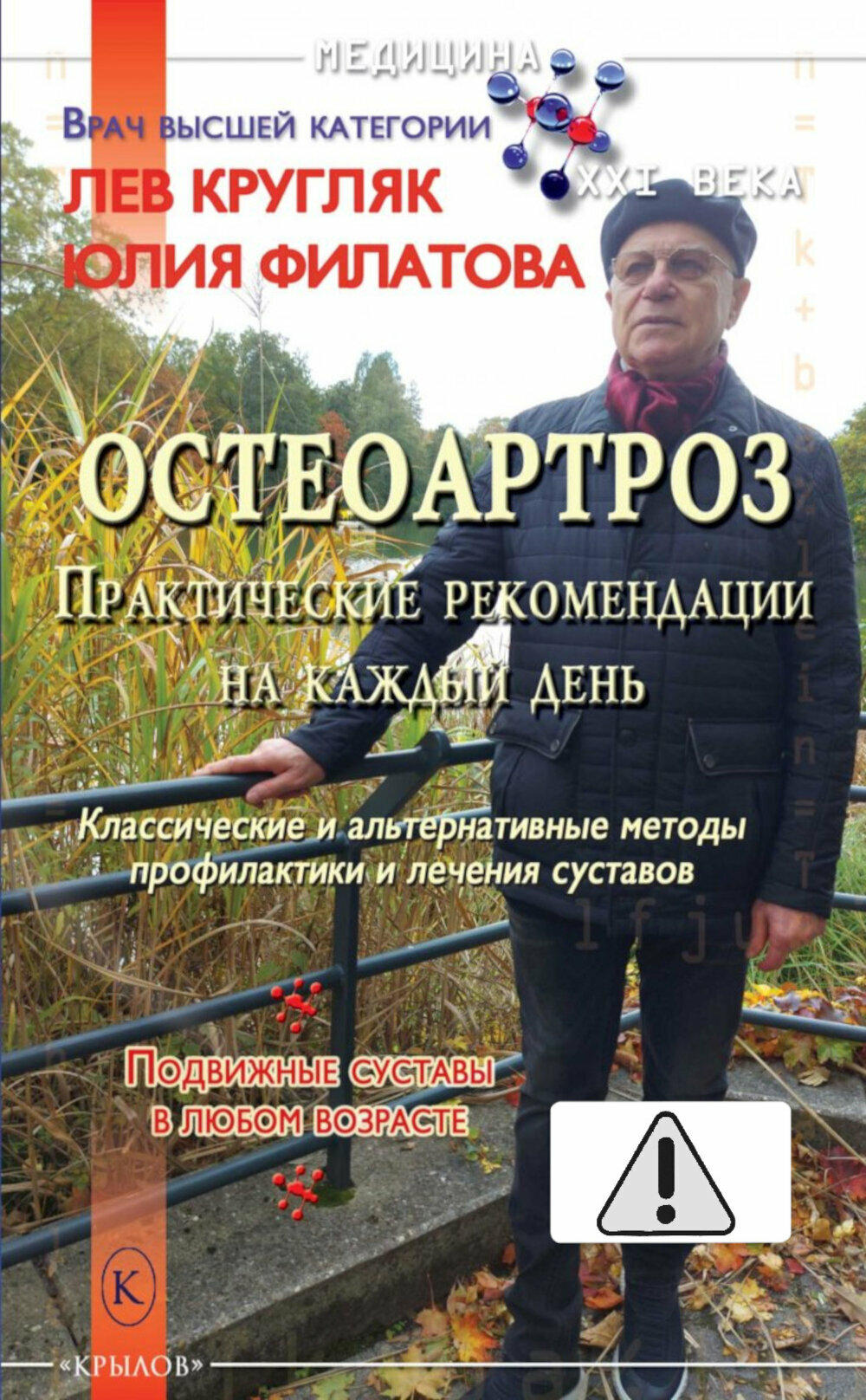 Остеоартроз. Практические рекомендации на каждый день. Кругляк Л. Г, Филатова Ю. С.