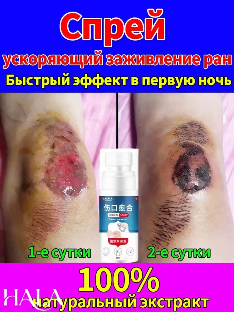 Спрей от пролежней и диабетической стопы: заживление ран, регенерация кожи, антибактериальное средство для лечения язв