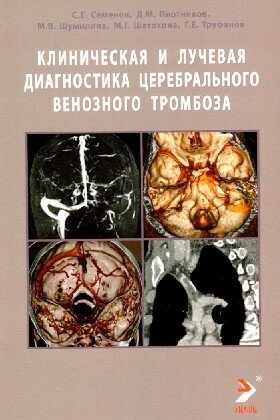 Клиническая и лучевая диагностика церебрального венозного тромбоза / Труфанов Г. Е.