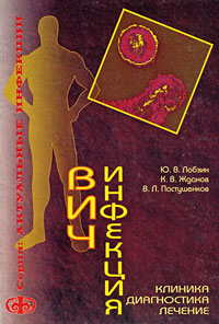 ВИЧ-инфекция. Клиника. Диагностика. Лечение