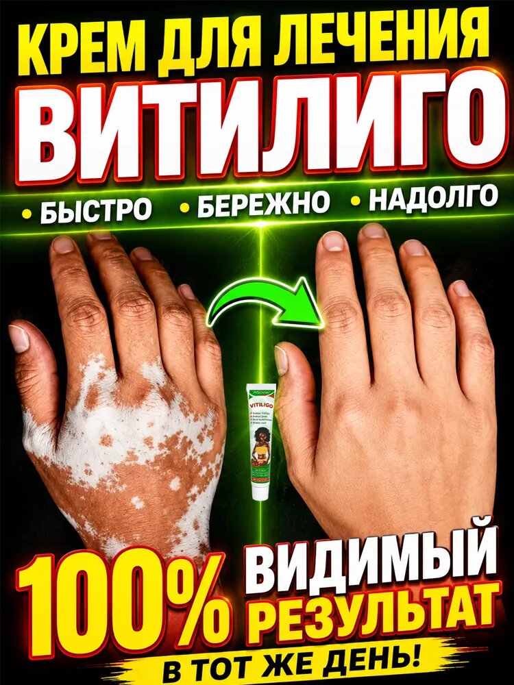 Крем от витилиго, белых пятен. для усиления пигментации при витилиго лейкодерма, лишай, бурые пятна. для депигментированных белых пятен кожи.5 штук, 100 грамм