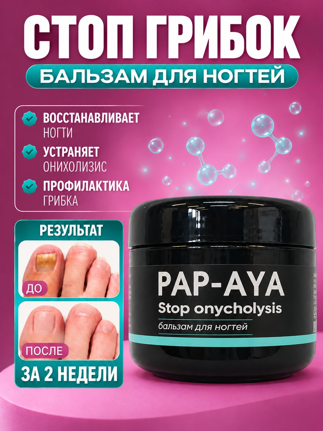 Средство от грибка ногтей на ногах и руках Бальзам Стоп онихолизис ногтей лечение и укрепление
