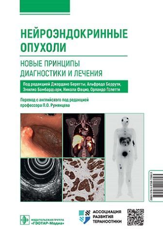 Нейроэндокринные опухоли. Новые принципы диагностики и лечения. Руководство для врачей