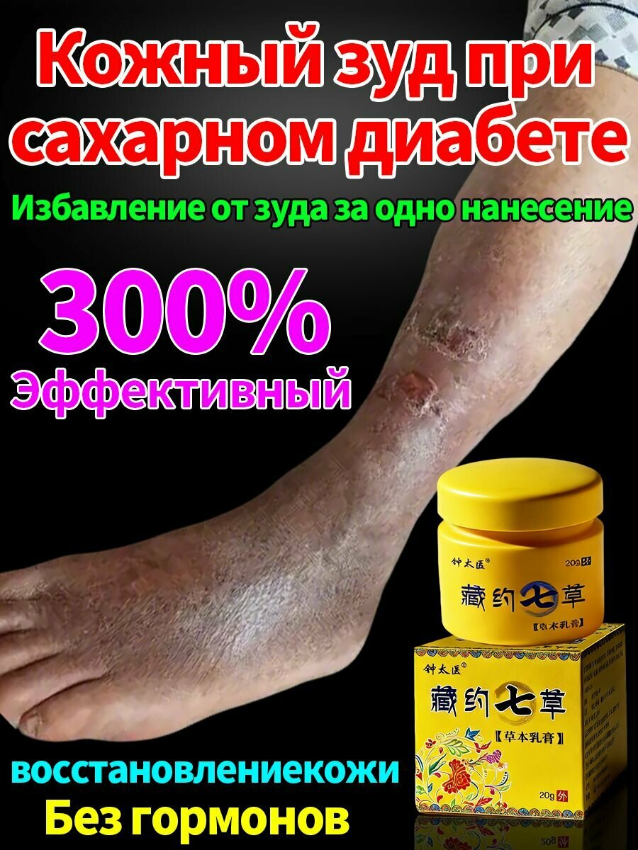 Мазь от кожного зуда при диабете быстрое облегчение