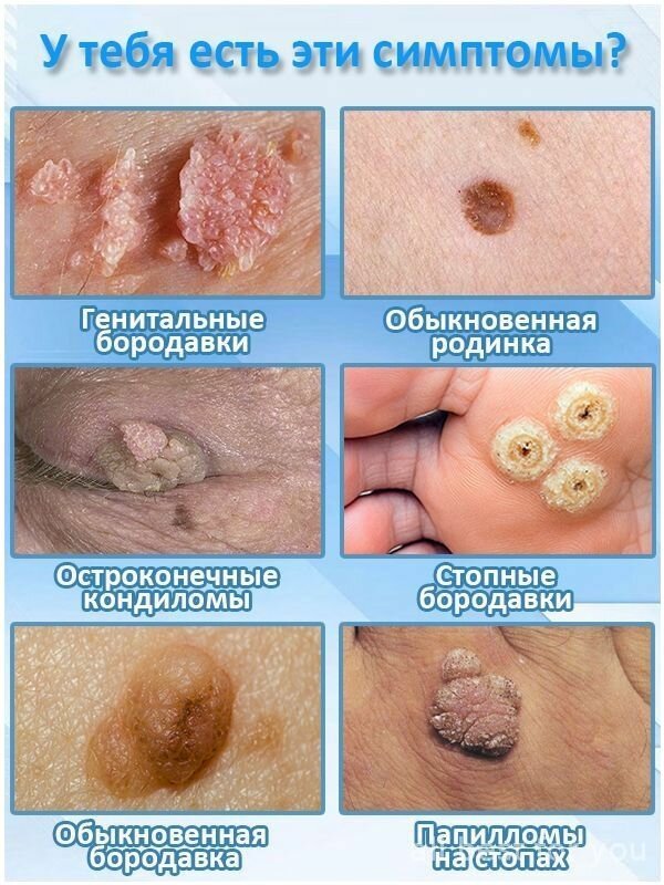 Бестселлер для ухода за кожей средство косметика