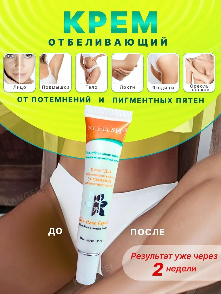 Отбеливающий крем для интимной зоны, от пигментных пятен, от пигментации на лице, крем для тела, для лица, интим гель