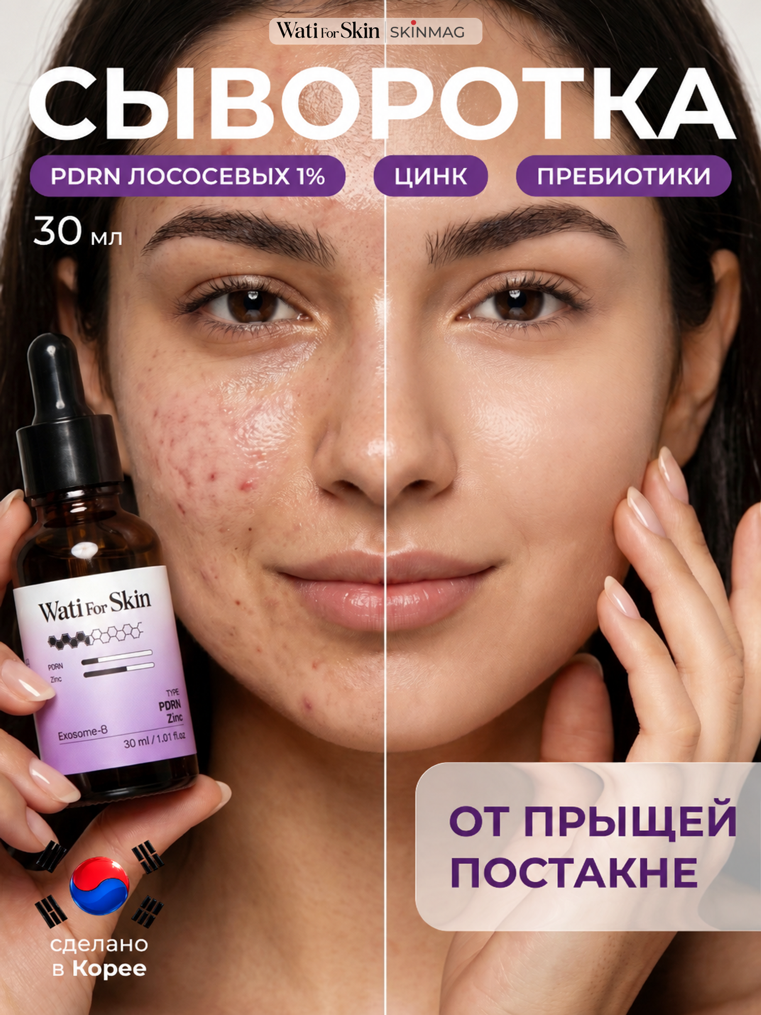 Сыворотка для проблемной кожи Wati For Skin, цинк и пробиотики, 30мл