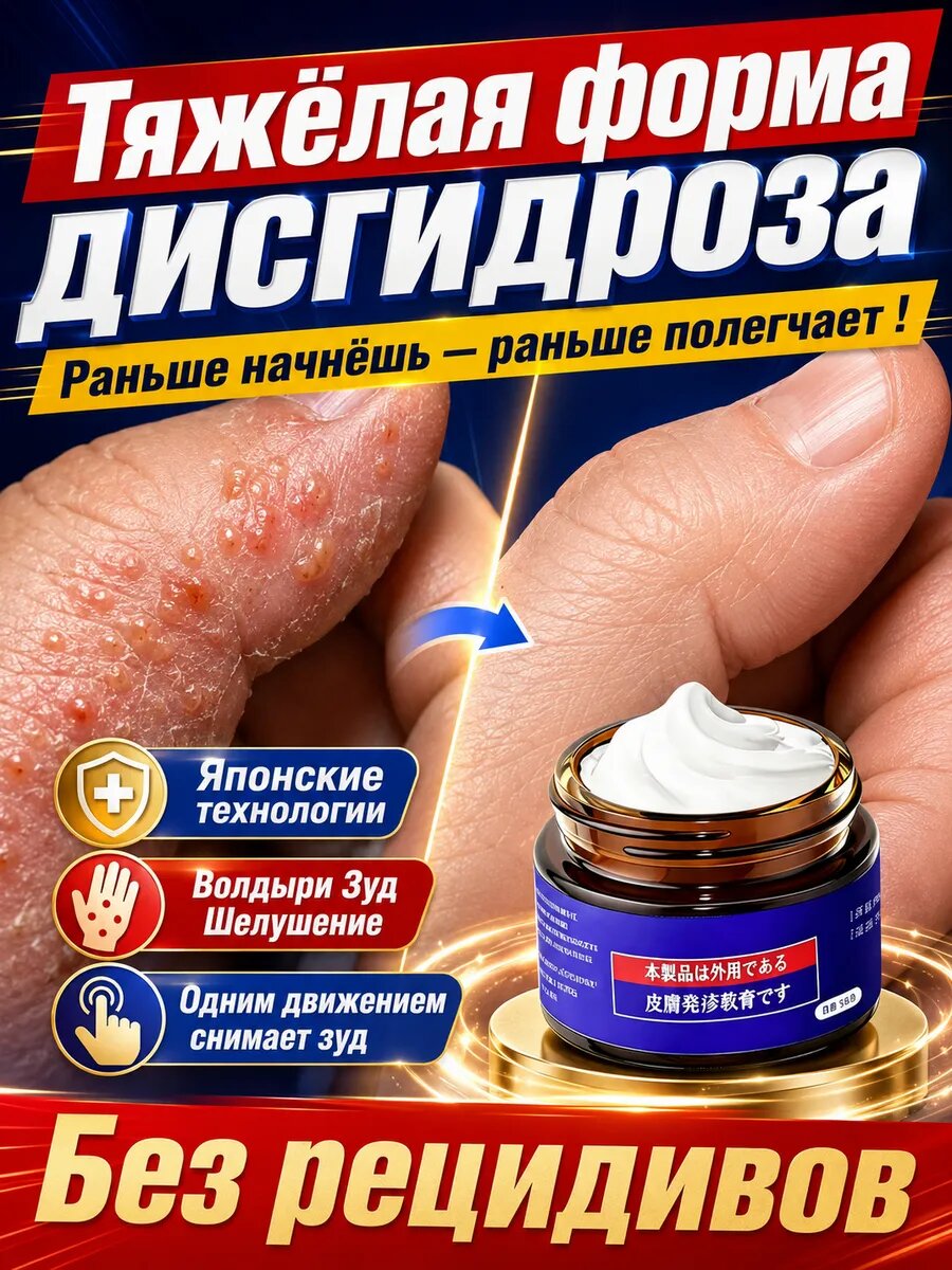 Мазь от дисгидроза от экземы на руках