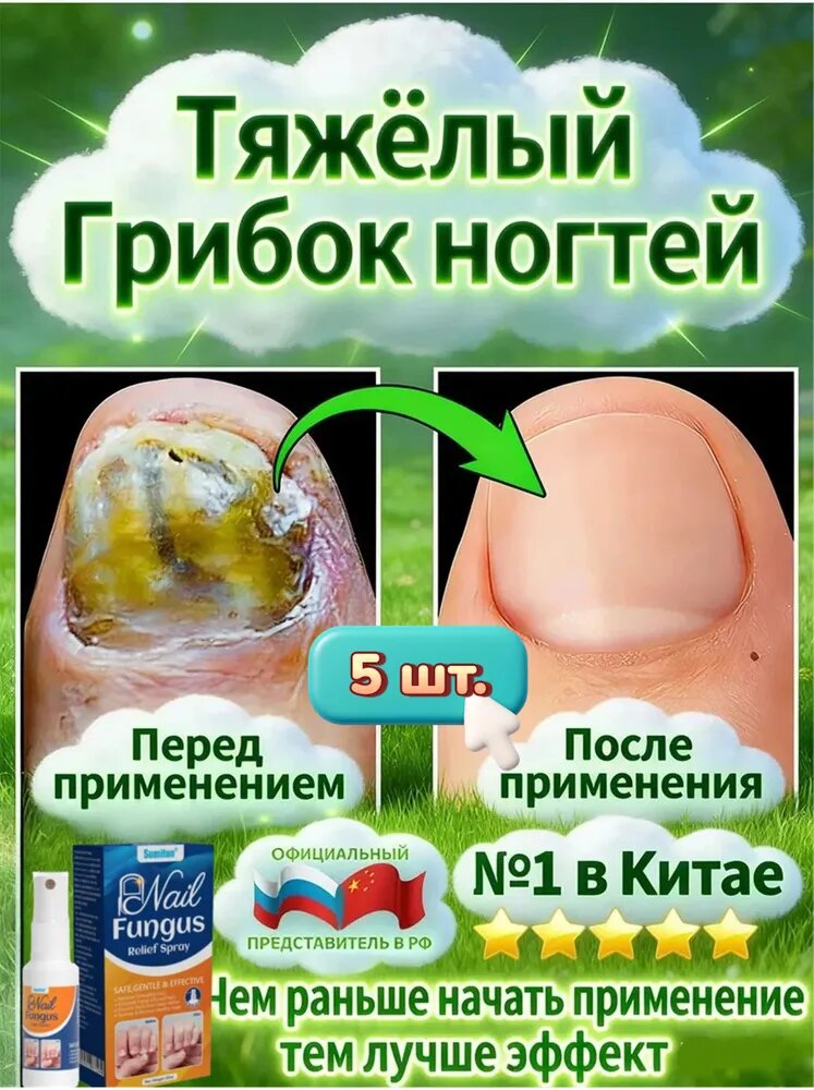 Спрей от онихомикоза масло от грибка ногтей на ногах. Средство от грибка ногтей на ногах