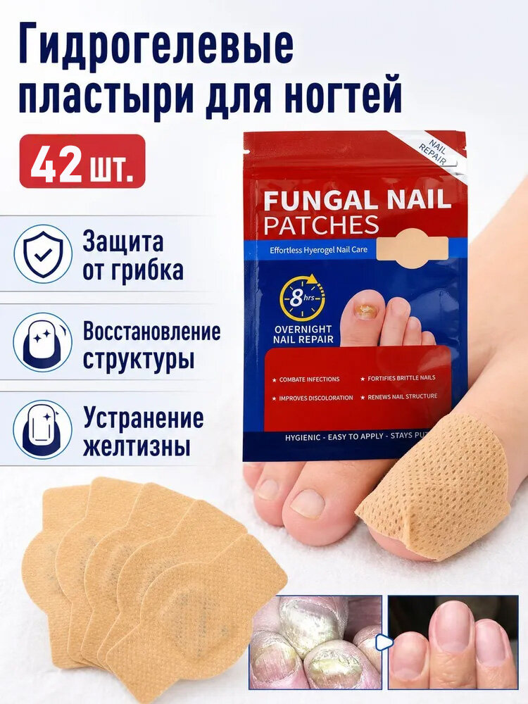 Пластыри для лечения онихомикоза, Грибковые поражения ногтей, 42 шт.