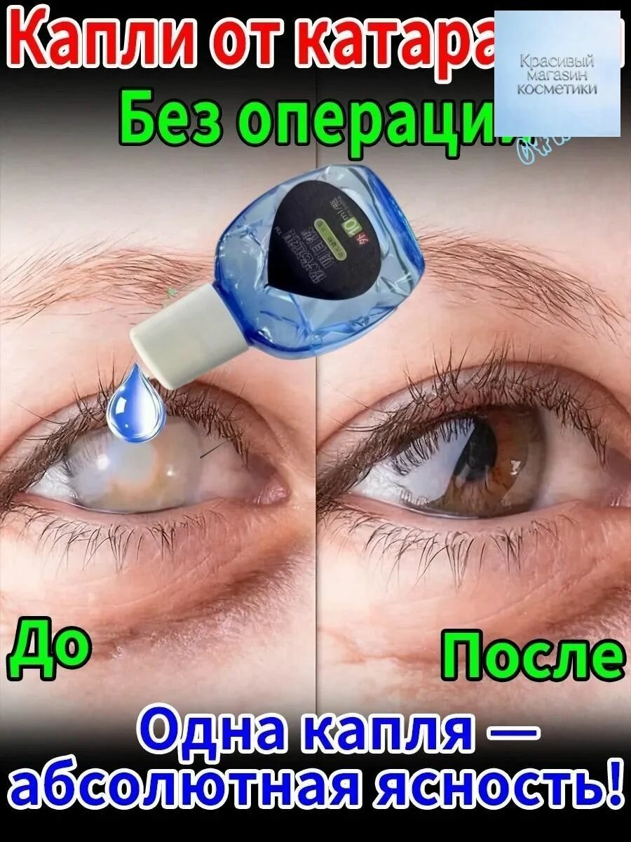 Глазные капли для облегчения лёгкой катаракты и глаукомы снятия усталости глаз 10 мл лёгкая катаракта глаукома усталость глаз