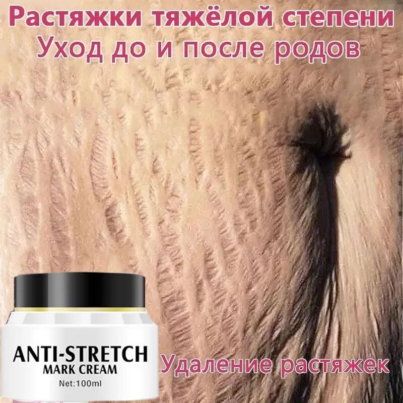Крем от растяжек для беременных, для тела для профилактики растяжек при беременности и после родов, восстанавливает эластичность кожи, а, питает кожу, 100г