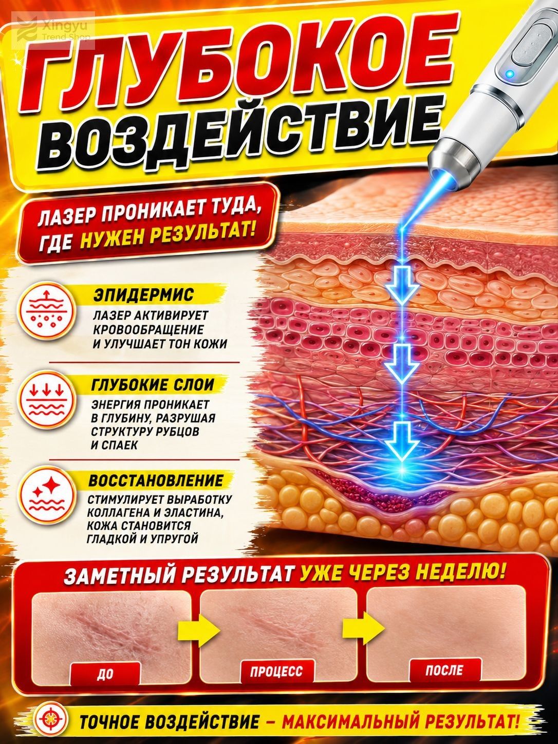 Келоидные рубцы, послеоперационные швы, ожоговые следы и растяжки: микрофракционный прибор 21