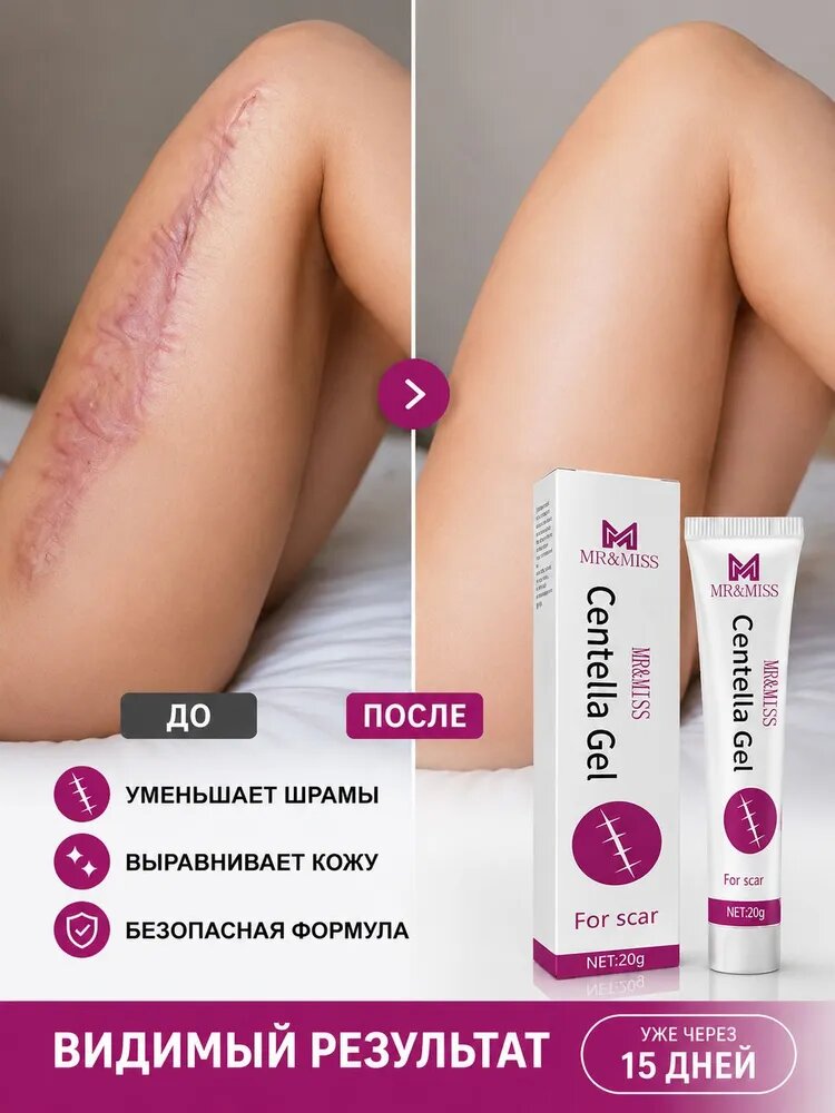 Крем от шрамов и рубцов 20 г, уход для лица и тела, от растяжек и пигментации, без отдушек, легкая текстура, быстро впитывается, ежедневный уход кожи