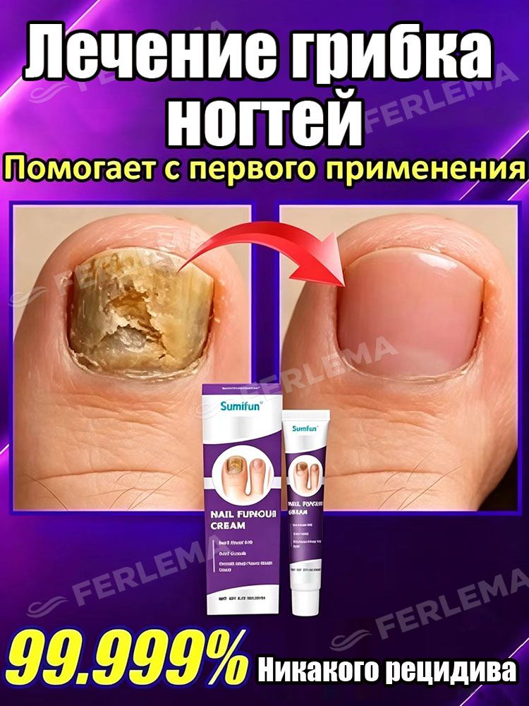 Эффективное средство от грибка ногтей на ногах, противогрибковая мазь для ног, уход за ногтями и кутикулой