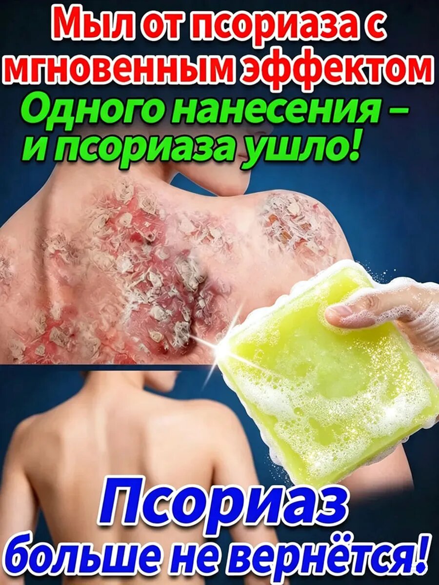 Мыло от прыщей на лице и тела 100r