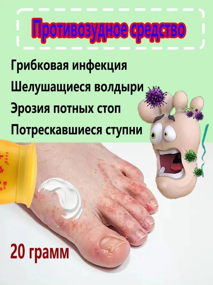 Мазь от грибка ног между пальцев, удаляет грибки, мазь для лечения зуда и язв, неприятного запаха ног, 20 г