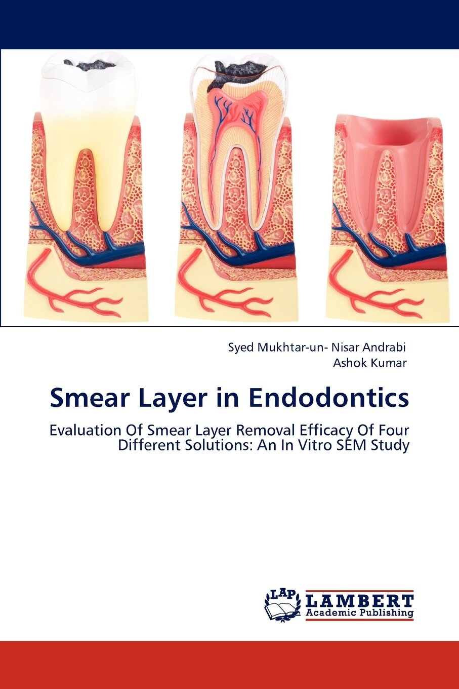 Smear Layer in Endodontics — фото 1