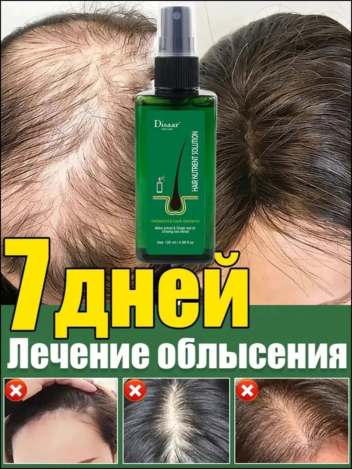 Профессиональный спрей для роста волос, эффективно стимулирует фолликулы, ускоряет рост и предотвращает выпадение, 120 мл