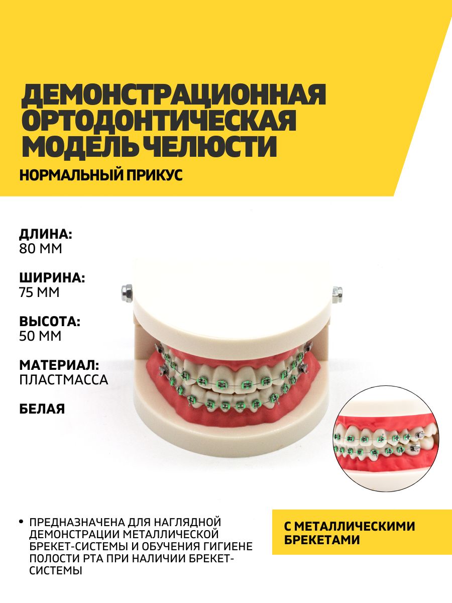 Демонстрационная модель челюсти с металлическими брекетами, нормальный прикус, белая