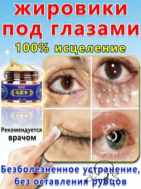Мазь от жировики под глазами Милиумы Просянка, 30 r