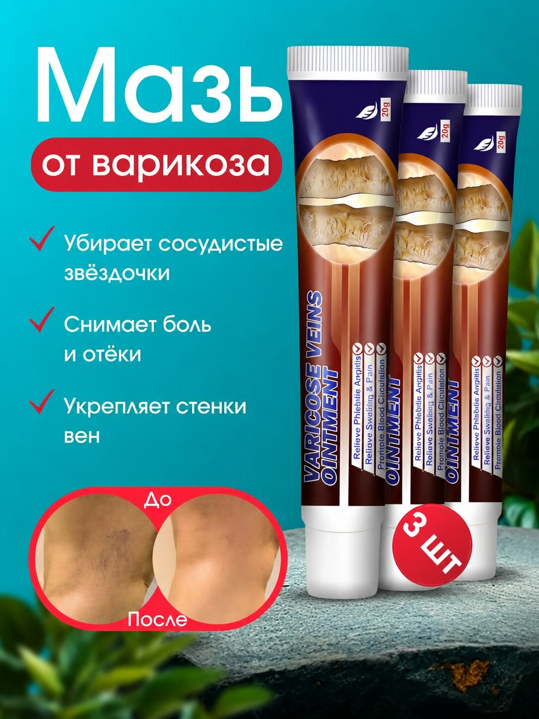 Мазь от варикоза и отёков ног 3шт , Средство при усталости вен