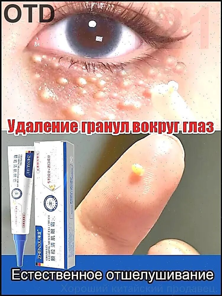 Эксклюзивный крем для век против жировиков, разглаживающий кожу и устраняющий дефекты, 30 г