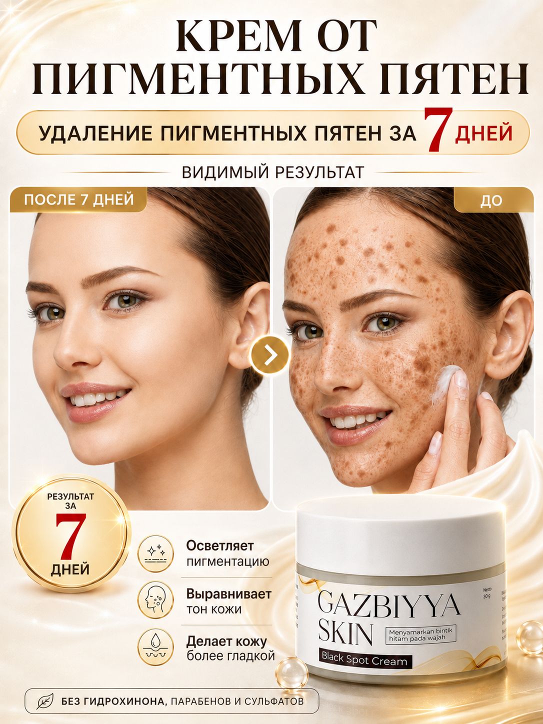 Крем для осветления и удаления пигментных пятен, направлен на устранение пигментации, осветление веснушек и старческих пятен, выравнивание тона кожи, 30 г.