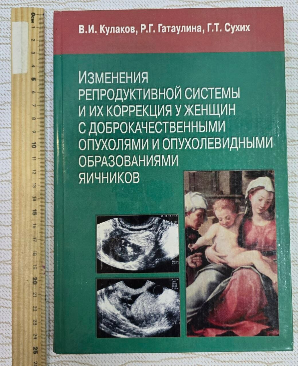 Изменения репродуктивной системы и их коррекция у женщин с доброкачественными опухолями и опухолевидными образованиями яичников. Кулаков В. И.