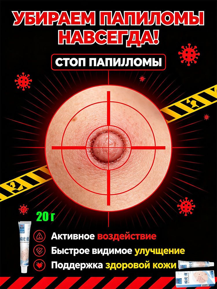 Крем от папиллом, бородавок и кондилом натуральное средство для удаления кожных наростов на лице и теле, размягчает и устраняет новообразо