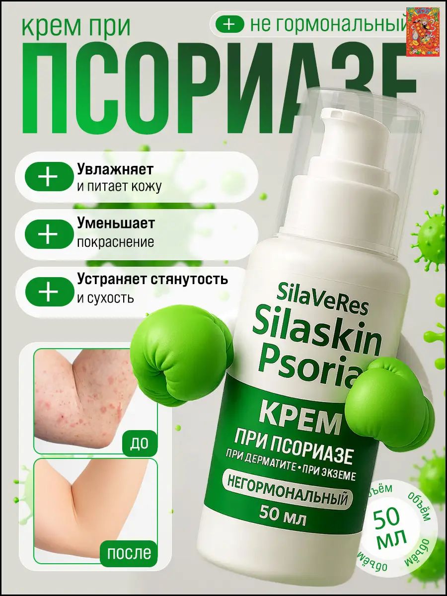 Крем при псориазе и дерматите, крем для проблемной кожи лица и тела 50 мл.