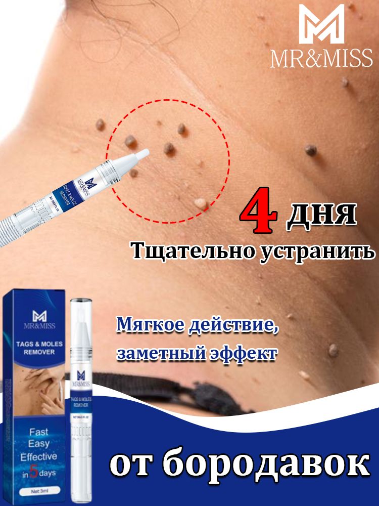 MR&MISS Ляписный карандаш от бородавок и папиллом, средство для ухода за кожей, точечное нанесение, 3 мл