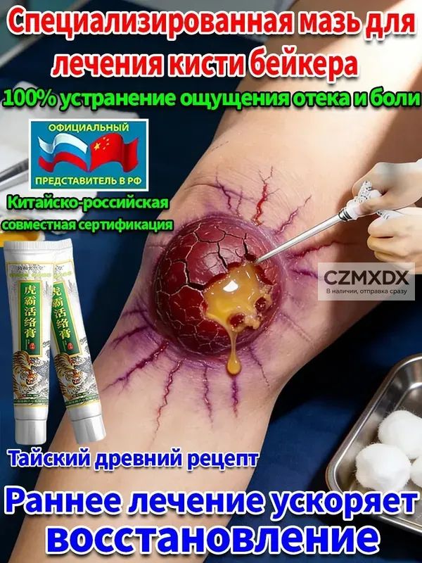 Волшебный китайский крем (от) кисты Бейкера, монастырская травница мазь для суставов. естественное решение для здоровья суставов.