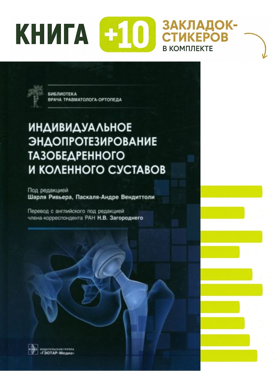 Индивидуальное эндопротезирование тазобедренного и коленного суставов. Комплект: книга + 10 закладок-стикеров