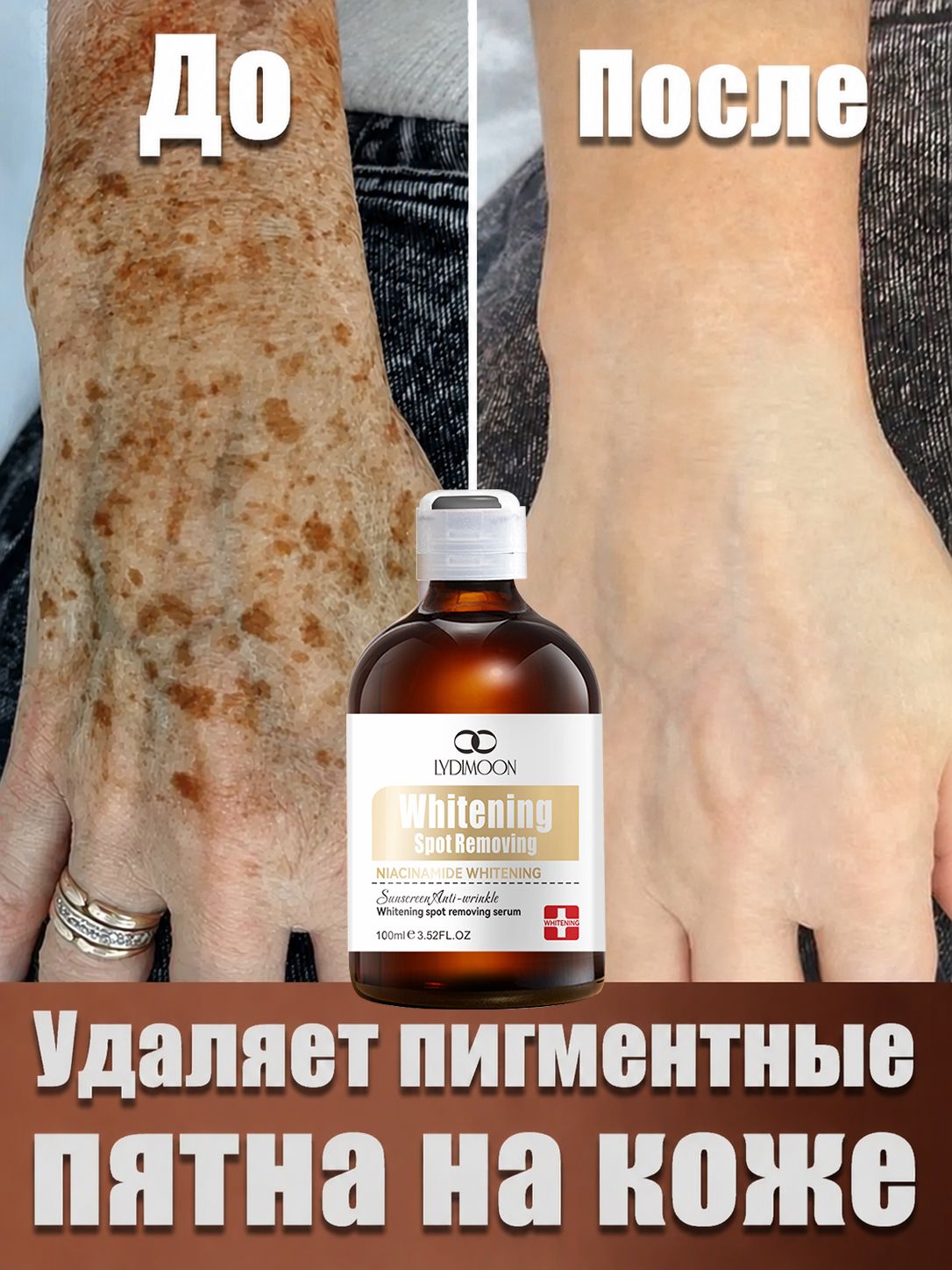 Сыворотка для лица от пигментных пятен с ниацинамидом 100 мл, от пигментации, для ровного тона кожи