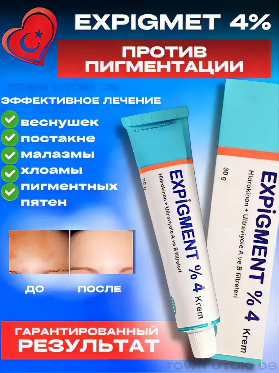 Отбеливающий крем для лица против пигментных пятен