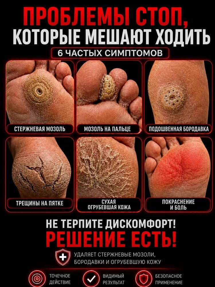 Китайская чудо мазь, Средство от мозолей и натоптышей на ногах, Лечение грибка стопы средство от зуда, запаха, шелушения и трещин на ногах Быстро снимает зуд