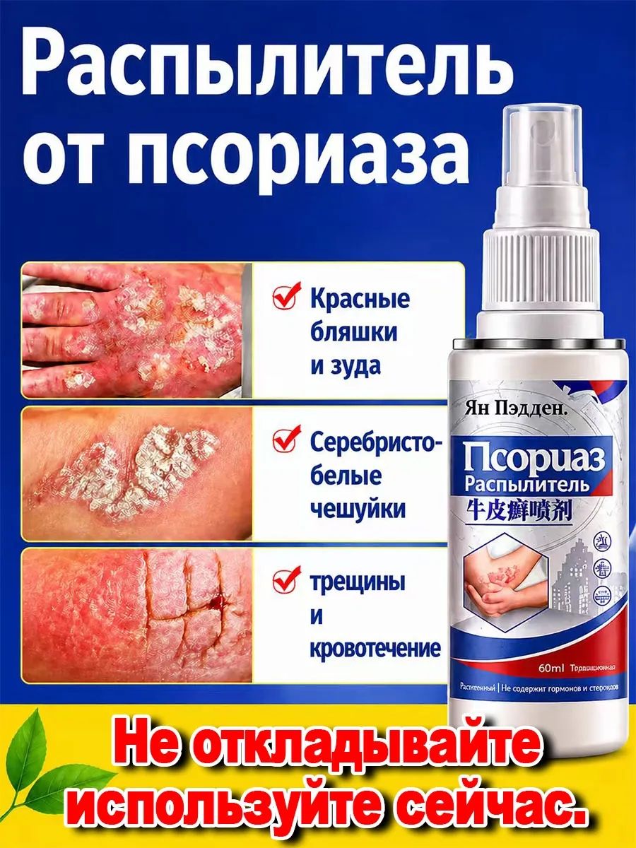Волшебное специальное лекарство, используемое для лечения псориаза и дерматита, снимающее зуд и шелушение и не имеющее побочных эффектов.60