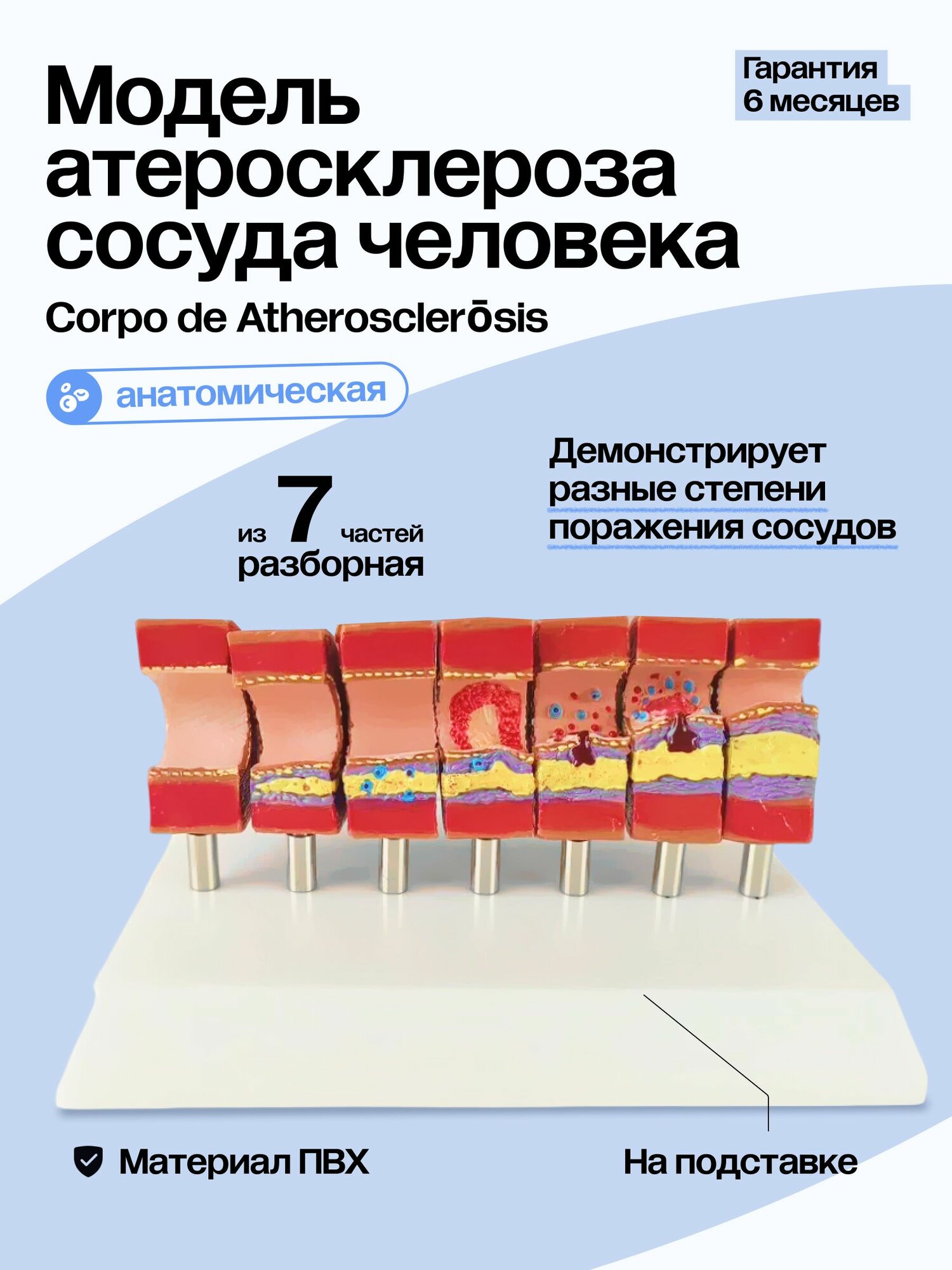 Разборная анатомическая модель атеросклероза сосуда Corpo de Atheroscler sis