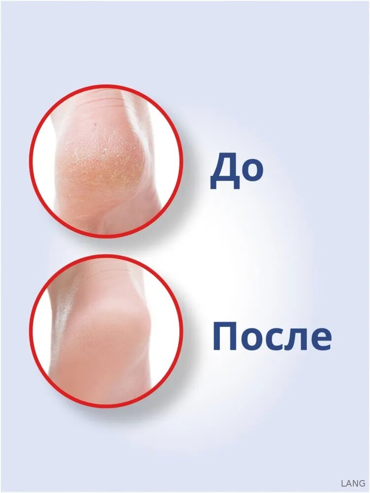 Силиконовые носочки — фото 1