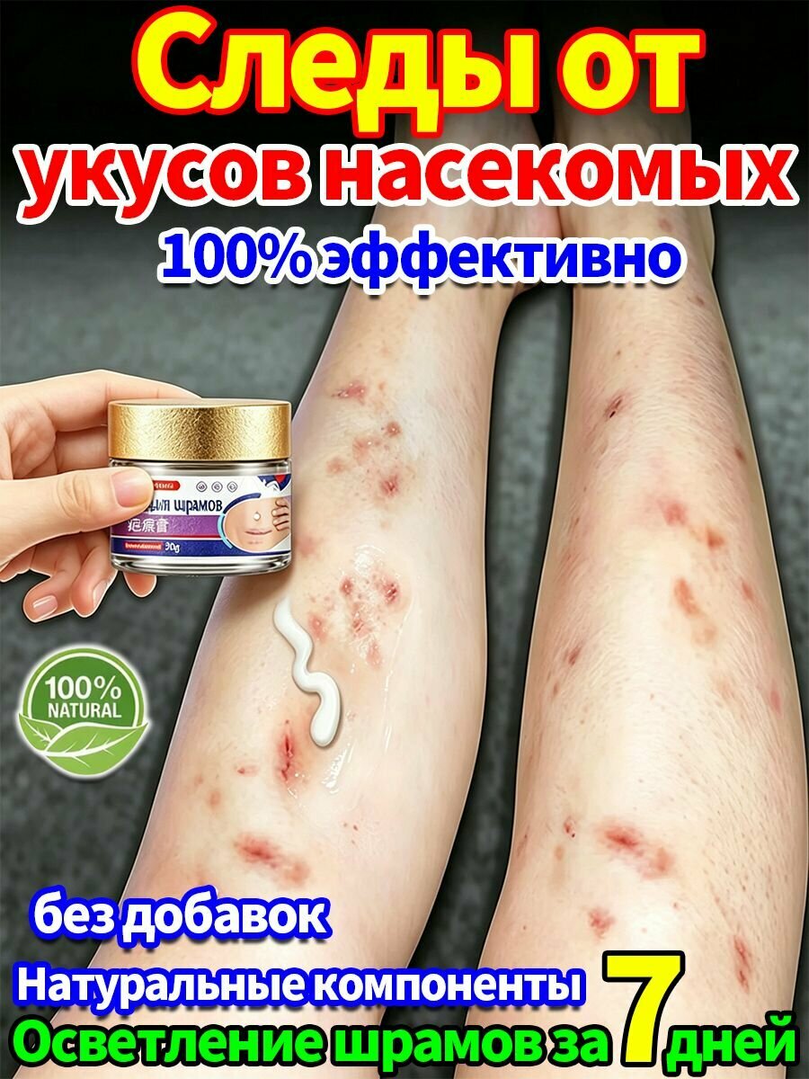 Мазь от пигментации и шрамов после укусов насекомых, 30 г