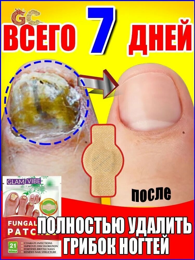 Пластырь для лечения ногтей для борьбы с грибком, Эффективное средство от грибка ногтей на ногах,21шт