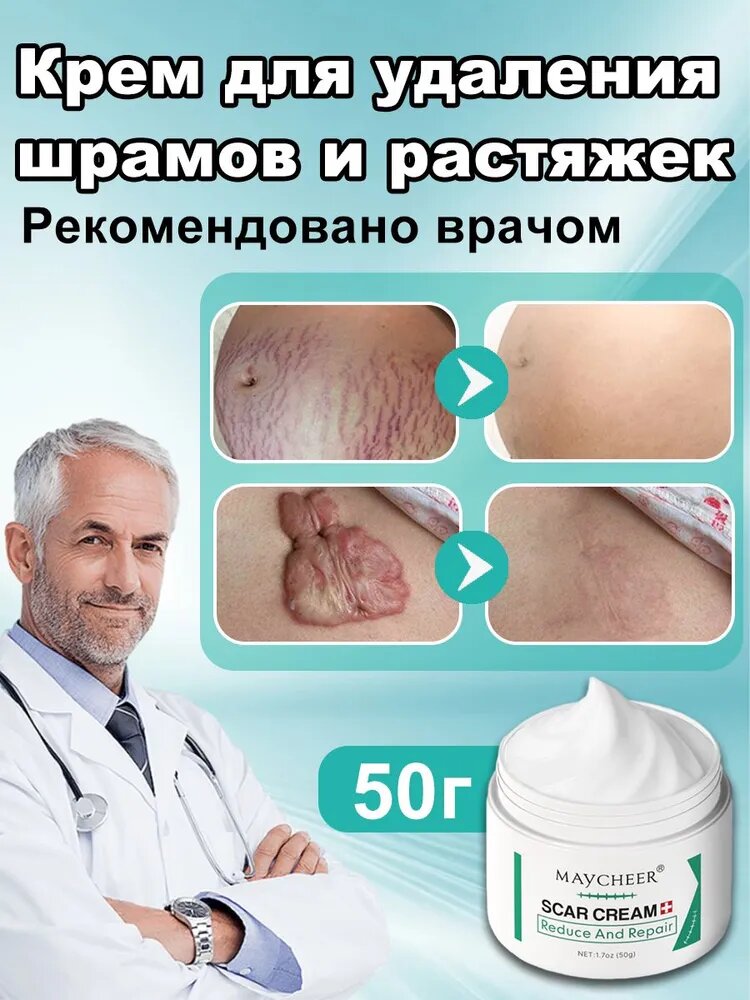 Крем от шрамов и рубцов, крем от растяжек,50g, Дети и взрослые, любая часть тела