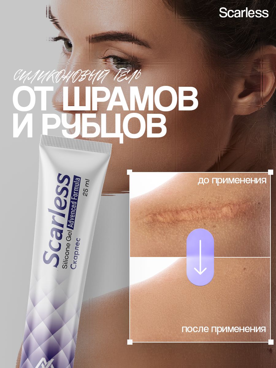 Гель от шрамов и рубцов Scarless / От постакне, крем от растяжек, от ожогов, на силиконовой основе / 25 мл