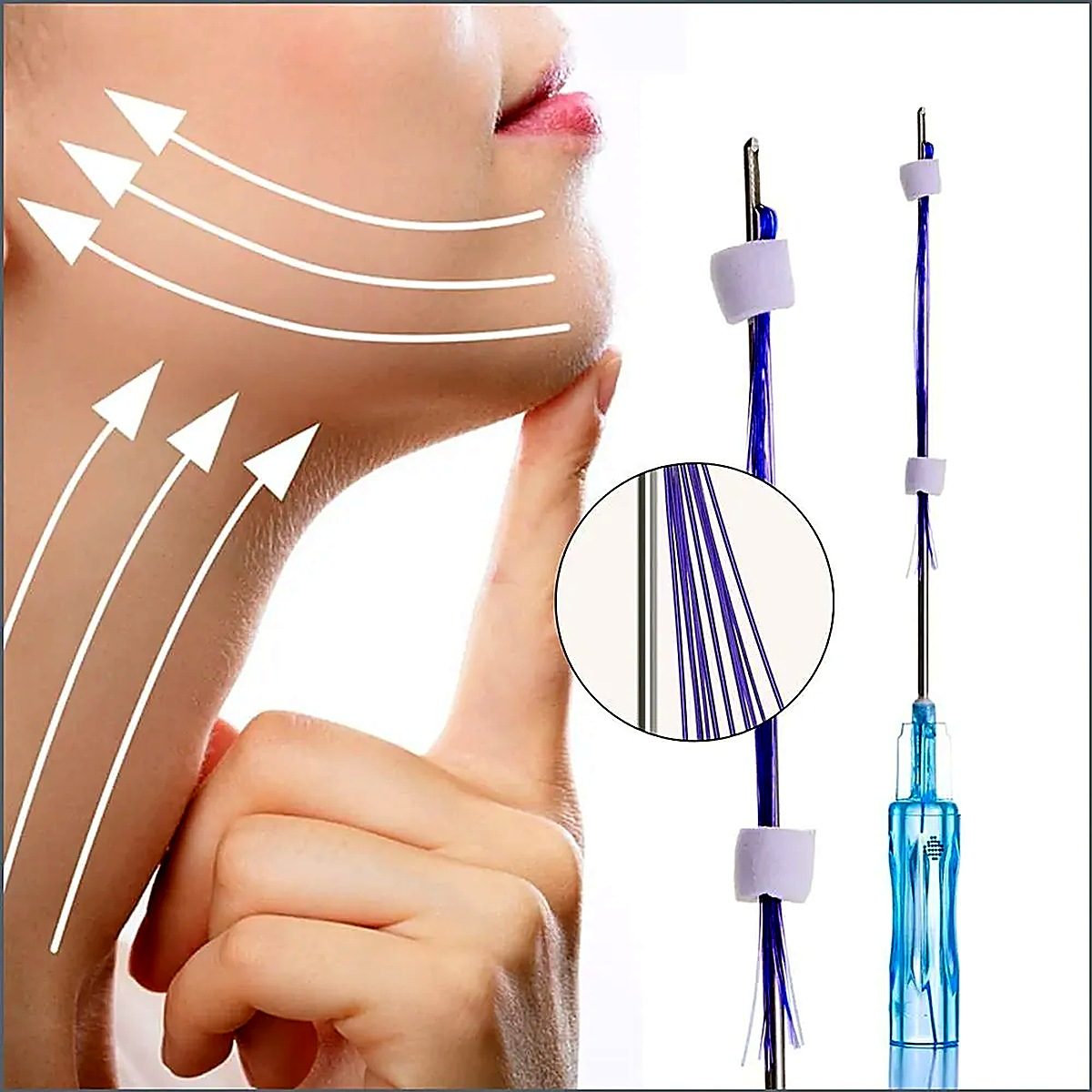 Нити Meki PDO Multi / Насечками Для Подтяжки Лица, 23G 38 Мм, 20 Штук В Упаковке